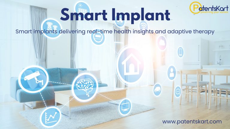 Smart Implant - Patentskart